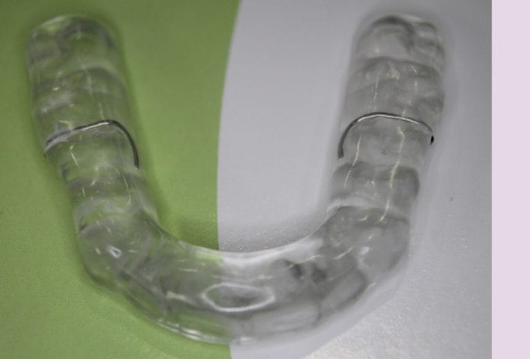 Bite Guards Langley | Astra Dental Centre